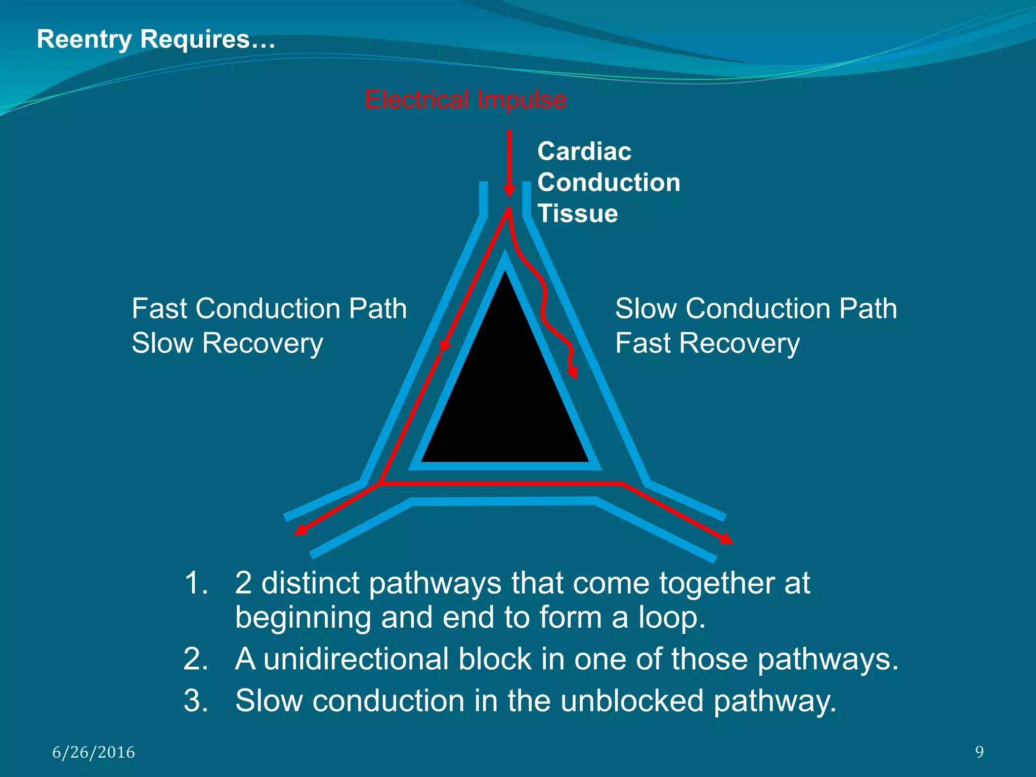 Approach to Arrhythmias | PPTX