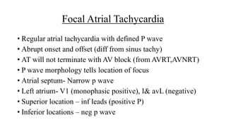 Approach to cardiac arrhythmias | PPTX