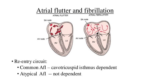 Approach to cardiac arrhythmias