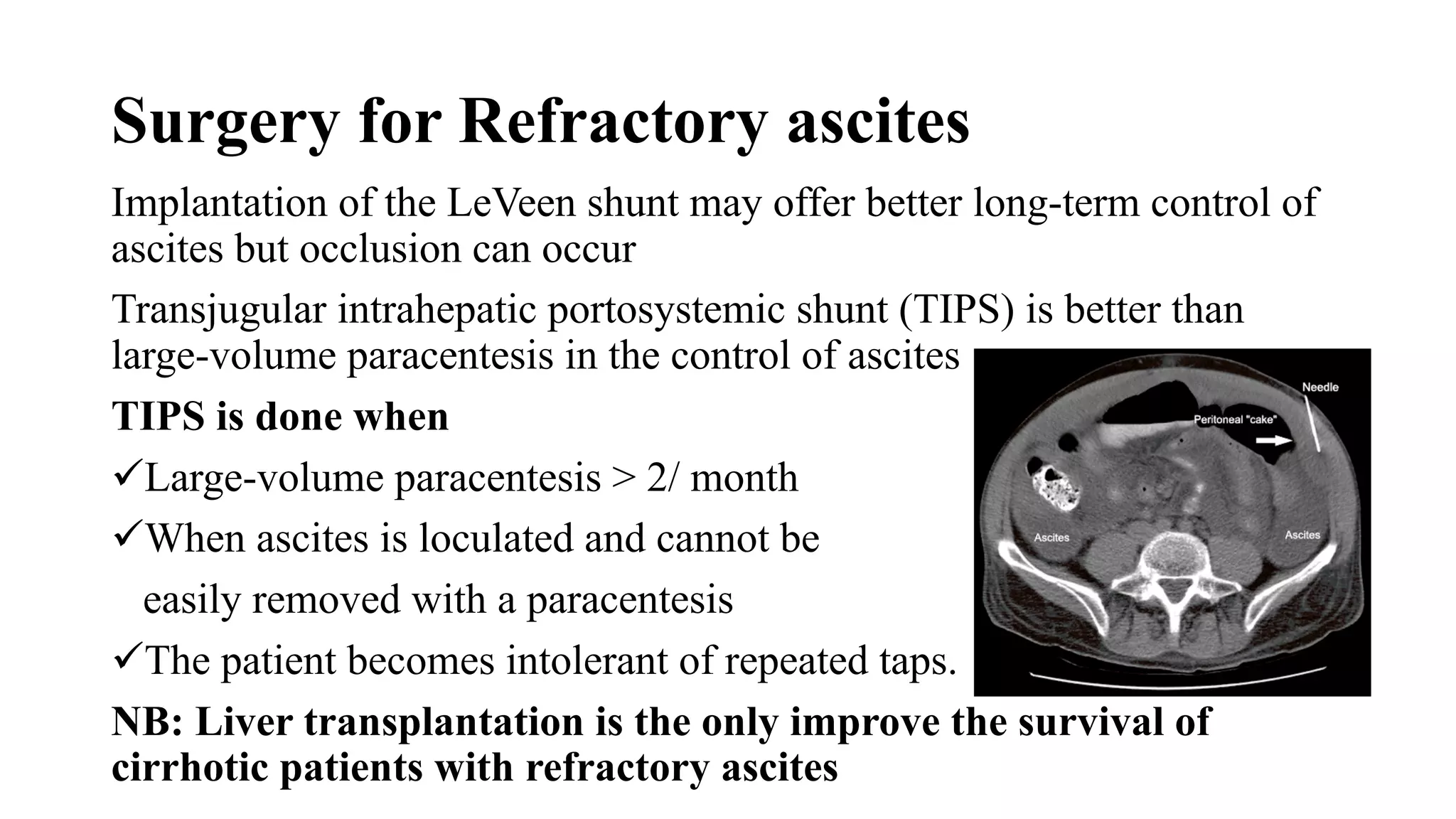 Approach to ascites | PDF