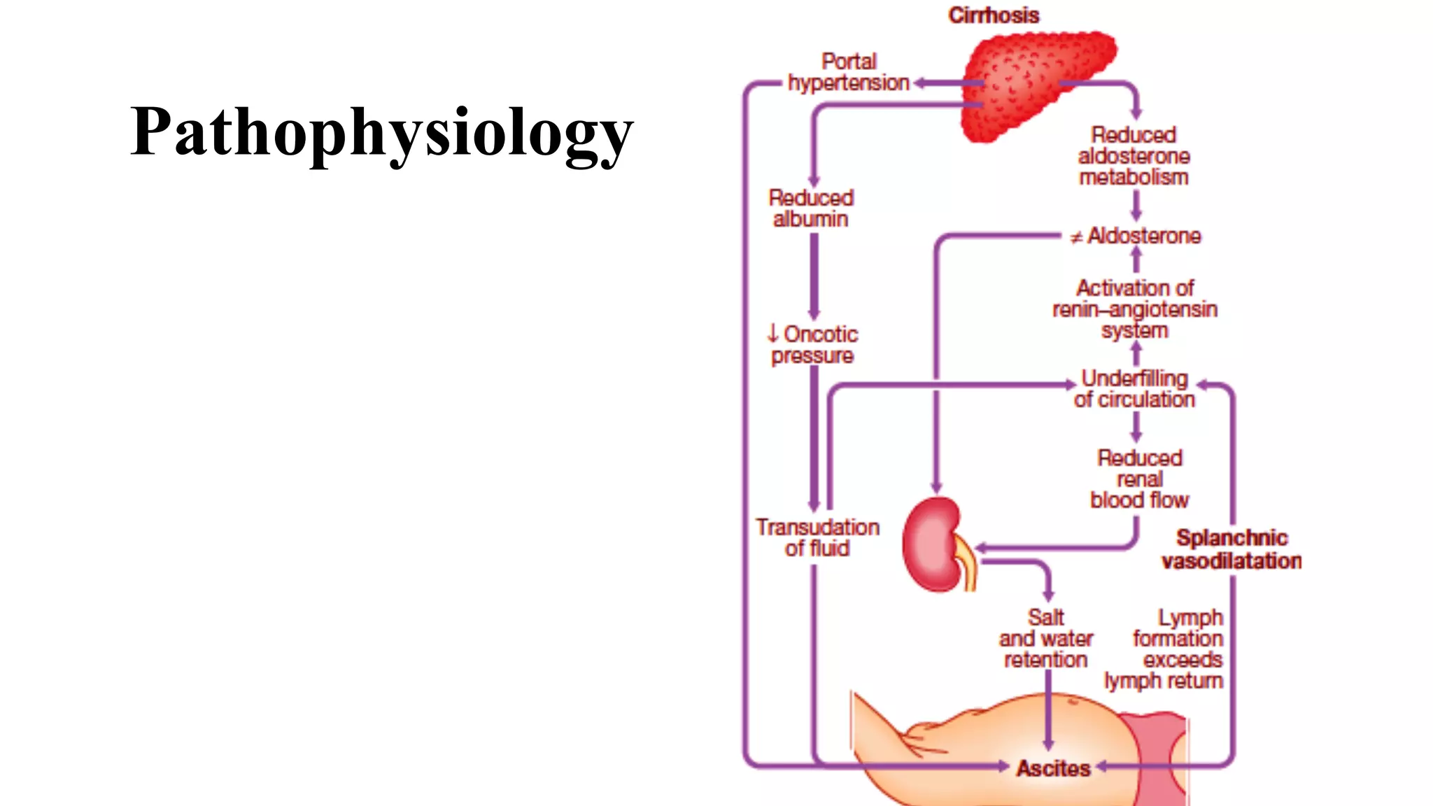 Approach to ascites | PDF