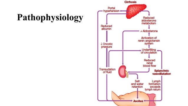 Approach to ascites | PDF | Blood Disorders | Diseases and Conditions