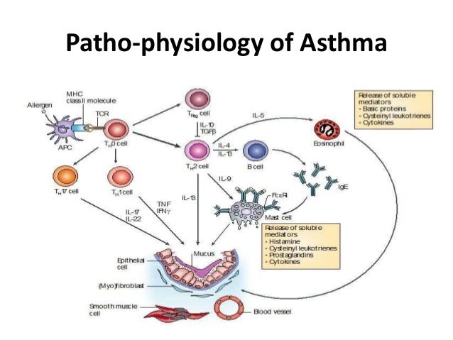 Approach to asthma