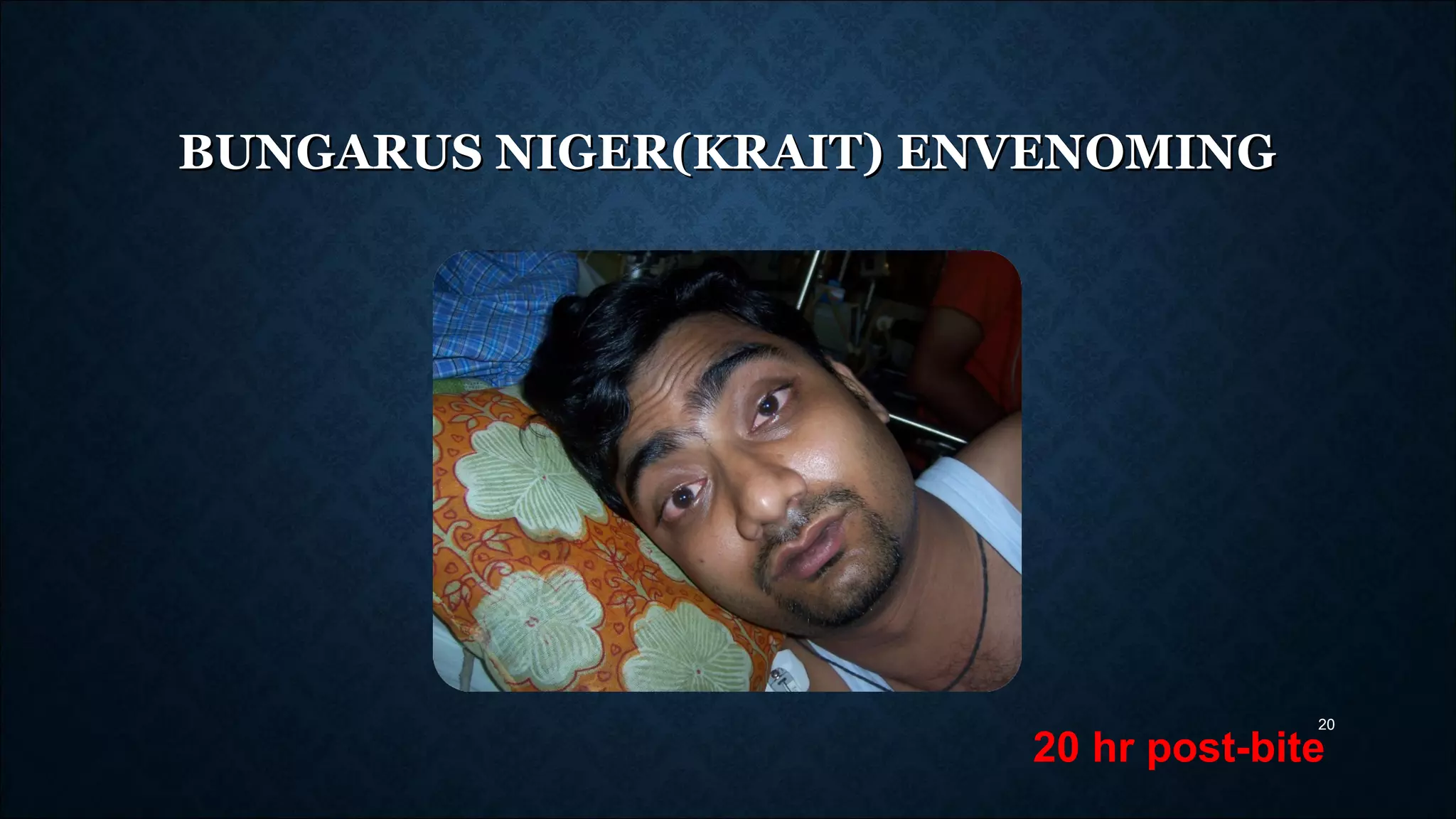 Approach to a victim of snake bite | PPT