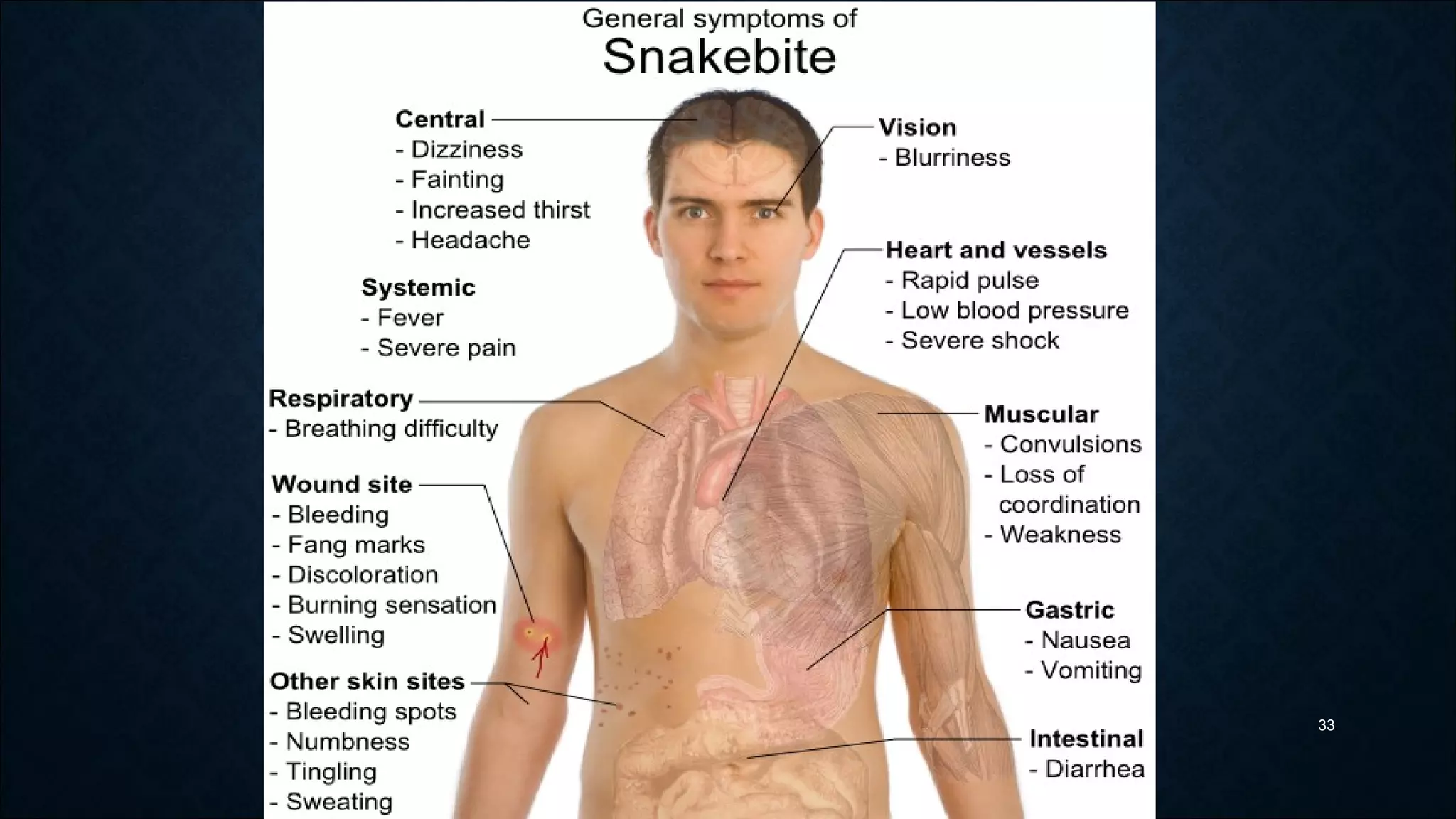 Approach to a victim of snake bite | PPT