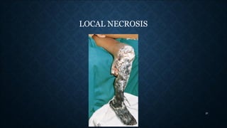 Approach to a victim of snake bite | PPT