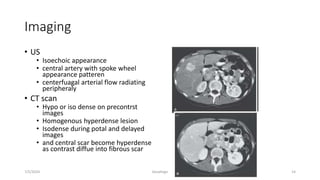 Approach to Benign and Malignant lesion of the liver.pptx