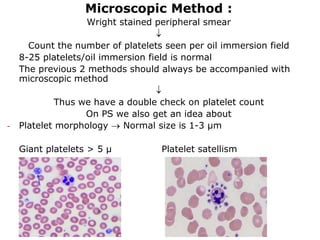 Approach to bleeding disorders | PPTX