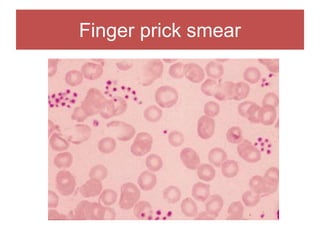 Approach to bleeding disorders | PPTX