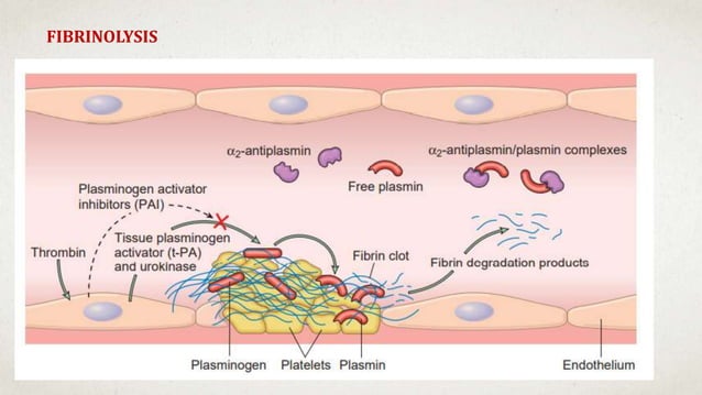 APPROACH TO BLEEDING DISORDERS/PLATELET DISORDERS.pptx | Blood ...