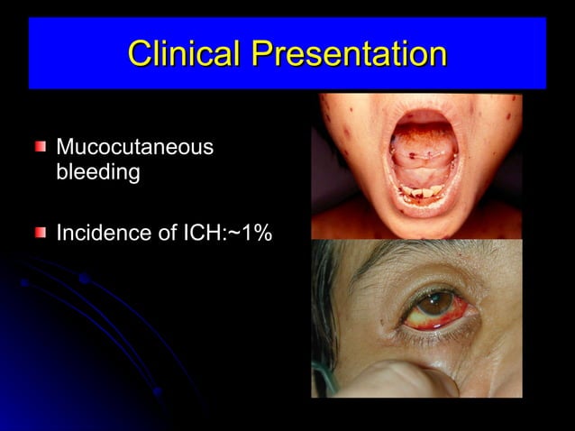 Approach to bleeding disorders and acute anemia | PPT