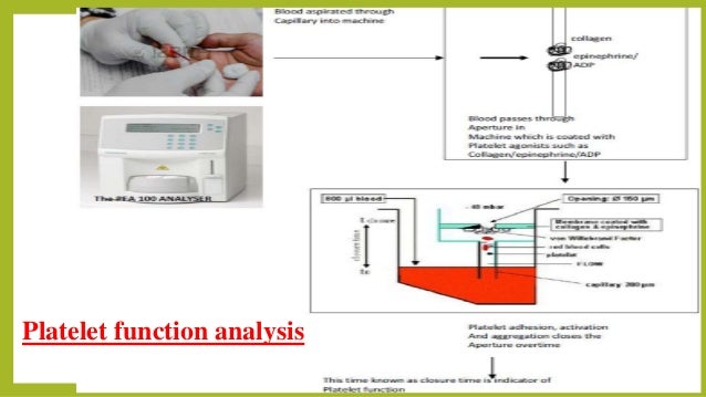 Approach to bleeding disorders part II