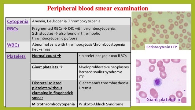 Approach to bleeding disorders part II