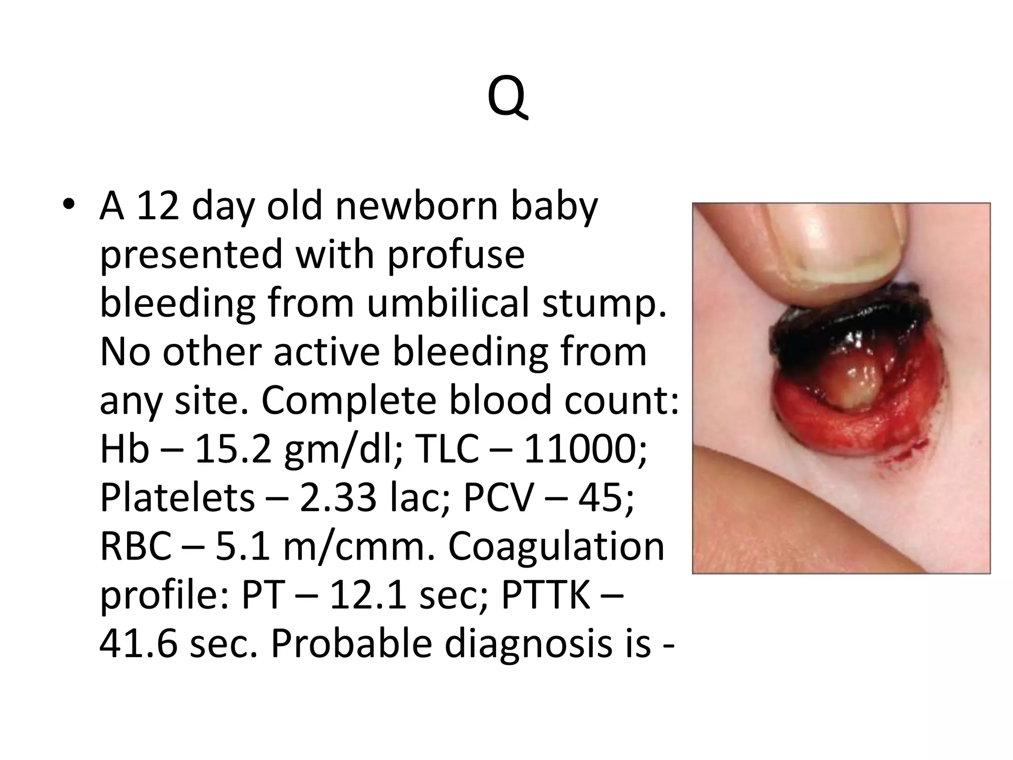 Approach to bleeding neonate | PPTX