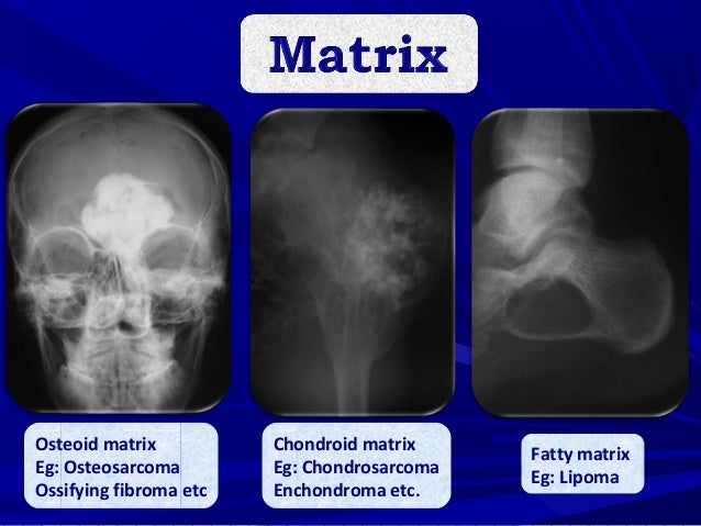 Illustrated Review of Approach to the Radiological Diagnosis of Bone