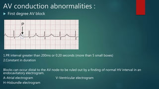 Approach to bradyarrythmias1 | PPTX