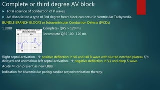 Approach to bradyarrythmias1 | PPTX