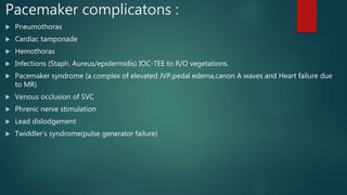Approach to bradyarrythmias1 | PPTX