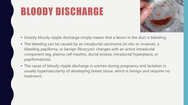 Approach to breast lump pain, nipple discharge | PPTX | Menopause ...