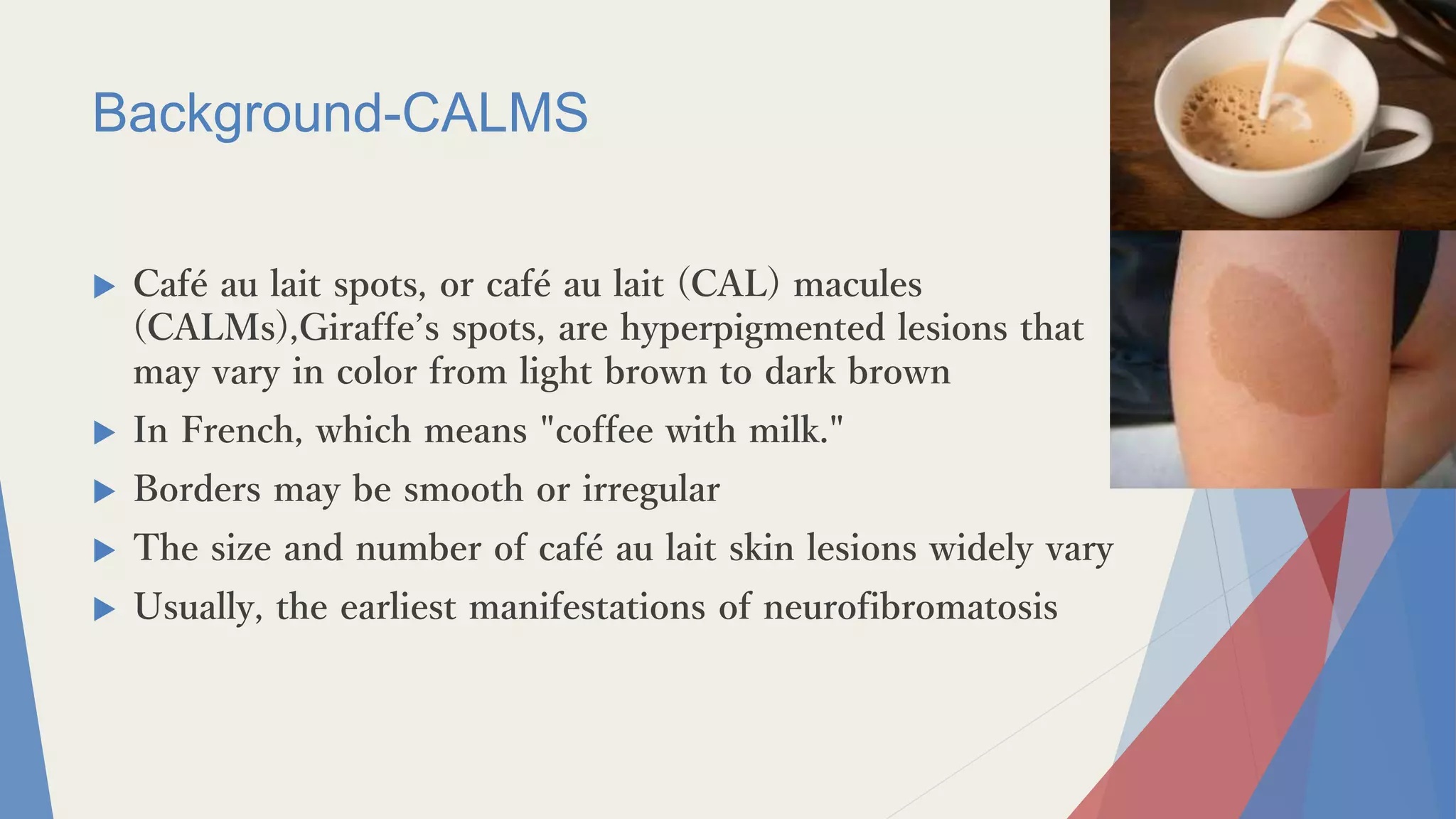 Approach to Cafe au lait spots in children | PPTX