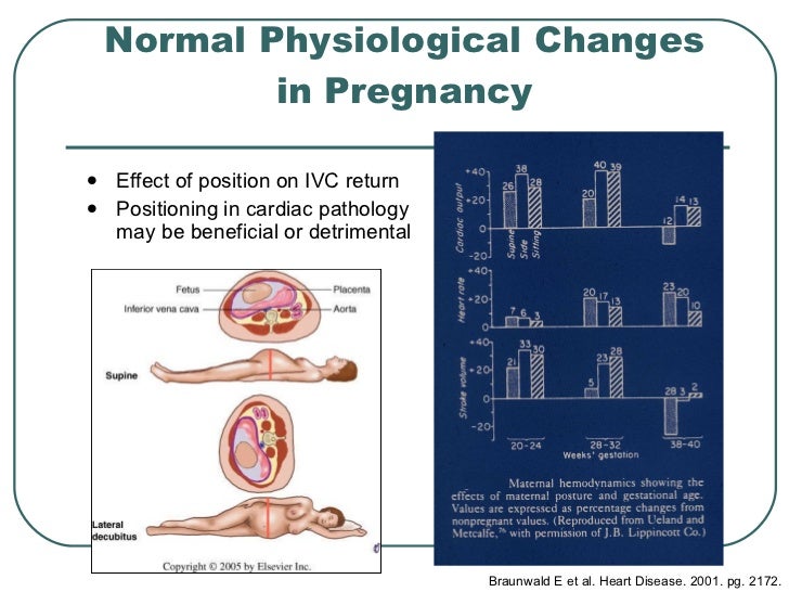Approach To Cardiac Diseases In Pregnancy