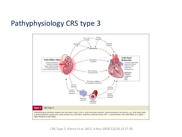 Approach to cardio renal syndrome