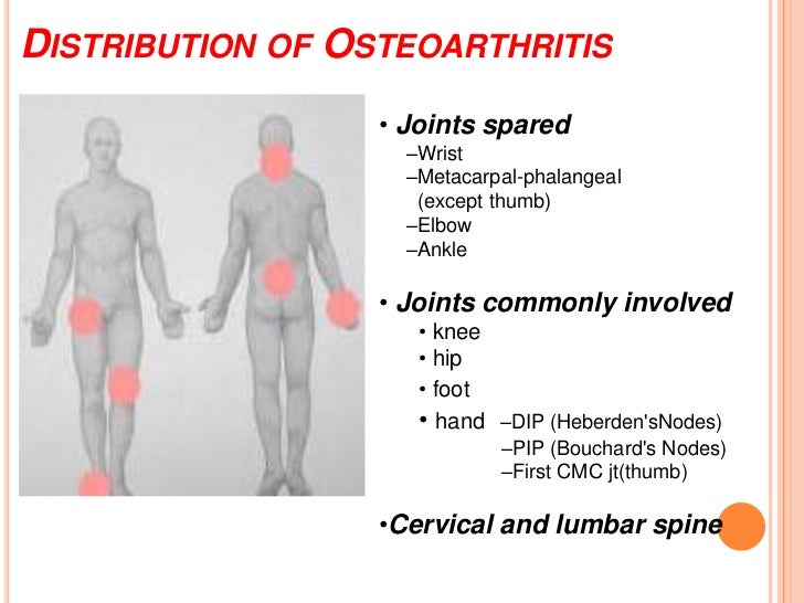 Approach to case of arthritis