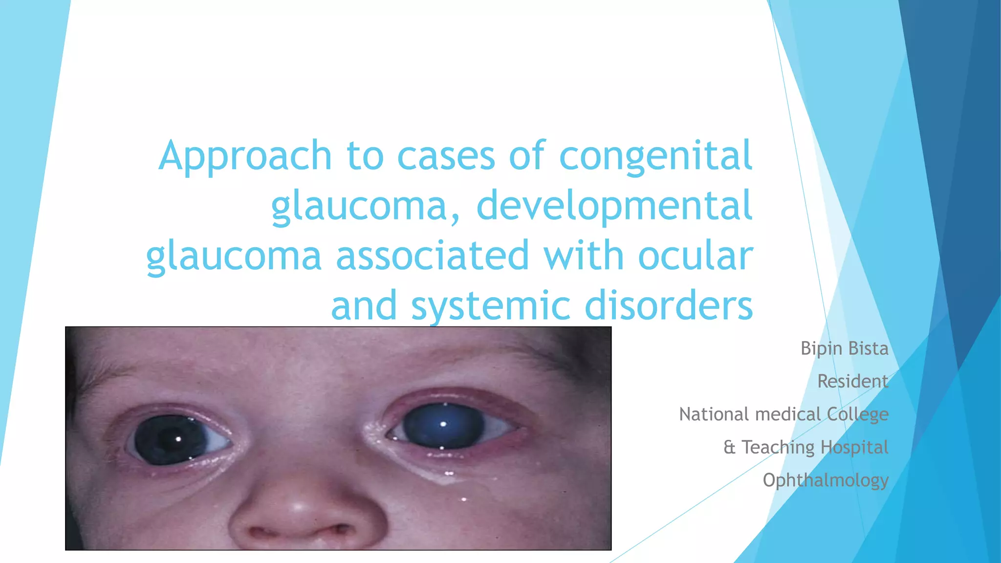 Approach to cases of congenital glaucoma, developmental | PPTX