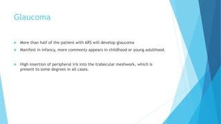 Approach to cases of congenital glaucoma, developmental | PPTX