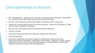 Approach to cases of congenital glaucoma, developmental | PPTX