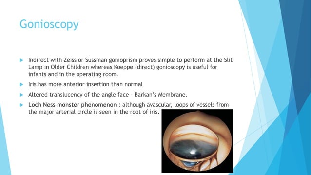 Approach to cases of congenital glaucoma, developmental | PPTX