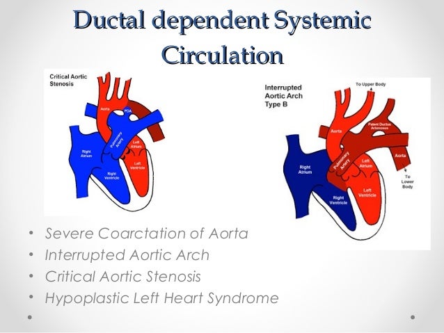 Congenital Heart Disease
