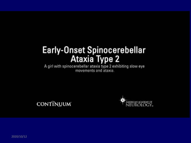 Approach to cerebellar ataxia | PPT | Brain and Nervous System Disorders | Diseases and Conditions
