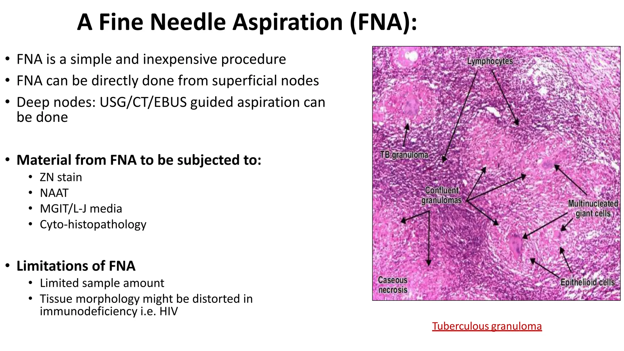 Approach to Cervical lymphadenopathy .pptx