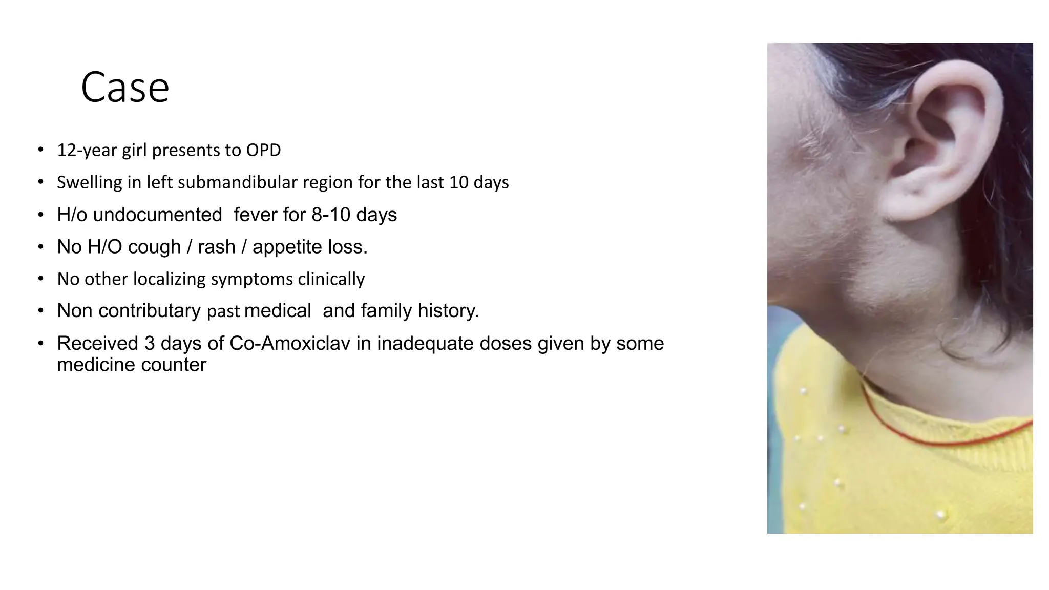 Approach to Cervical lymphadenopathy .pptx