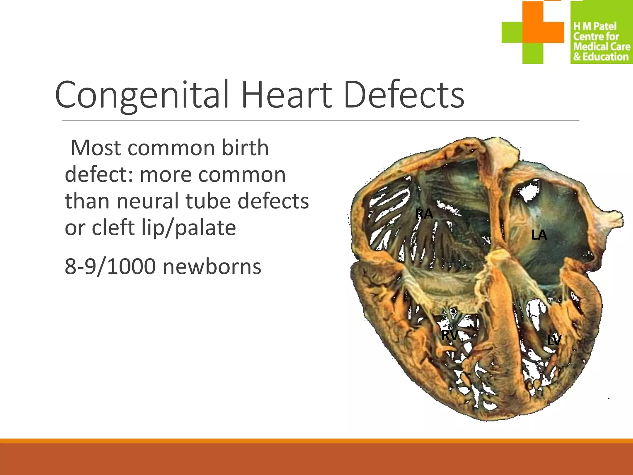 Approach to chd | PPTX