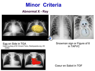 Approach to chd | PPTX