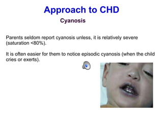 Approach to chd | PPTX
