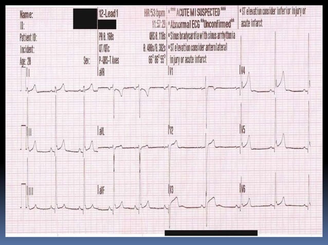 Approach to chest pain | PPTX | Lung and Respiratory Health | Diseases ...