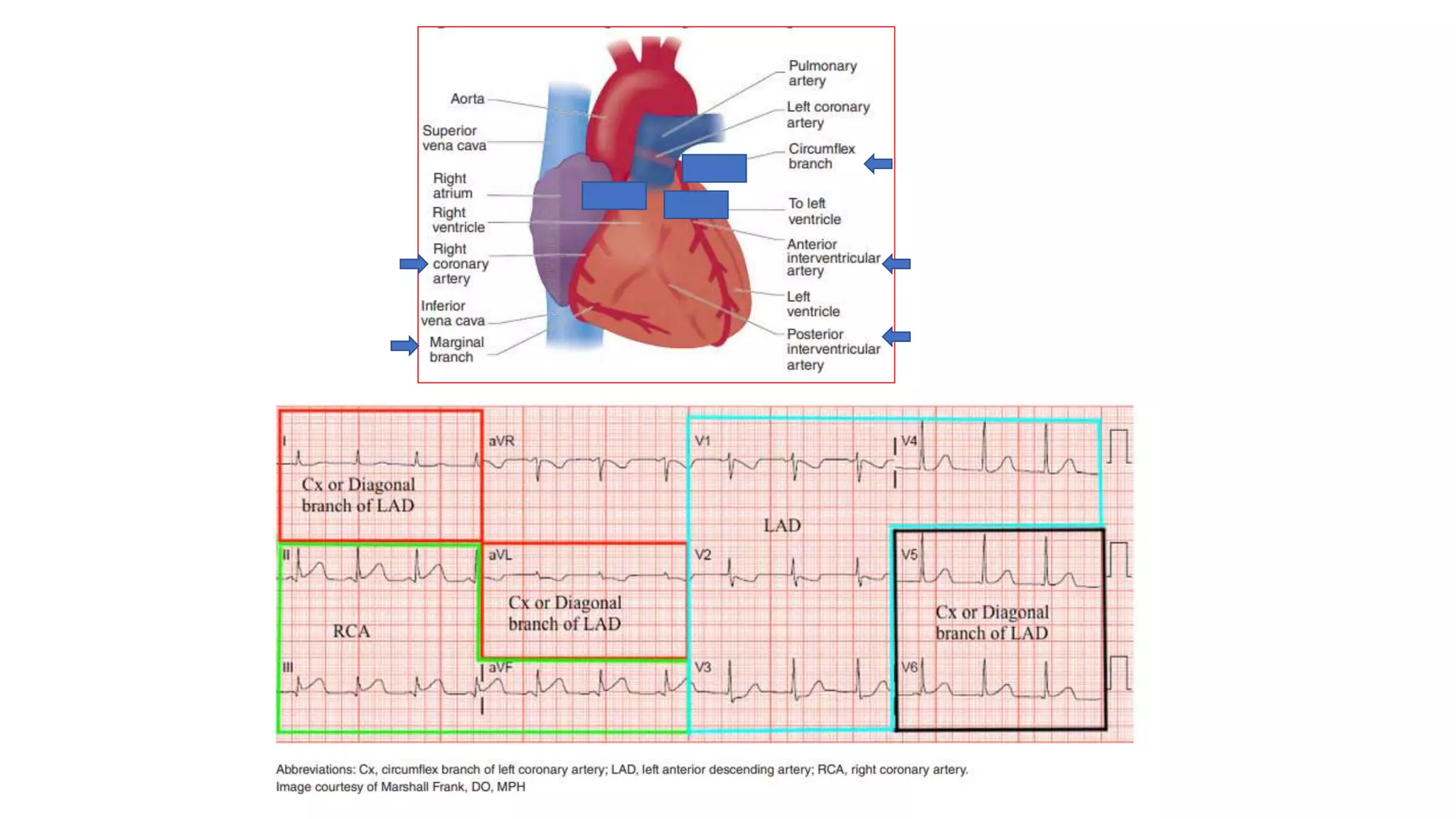 Approach to chest pain | PPTX