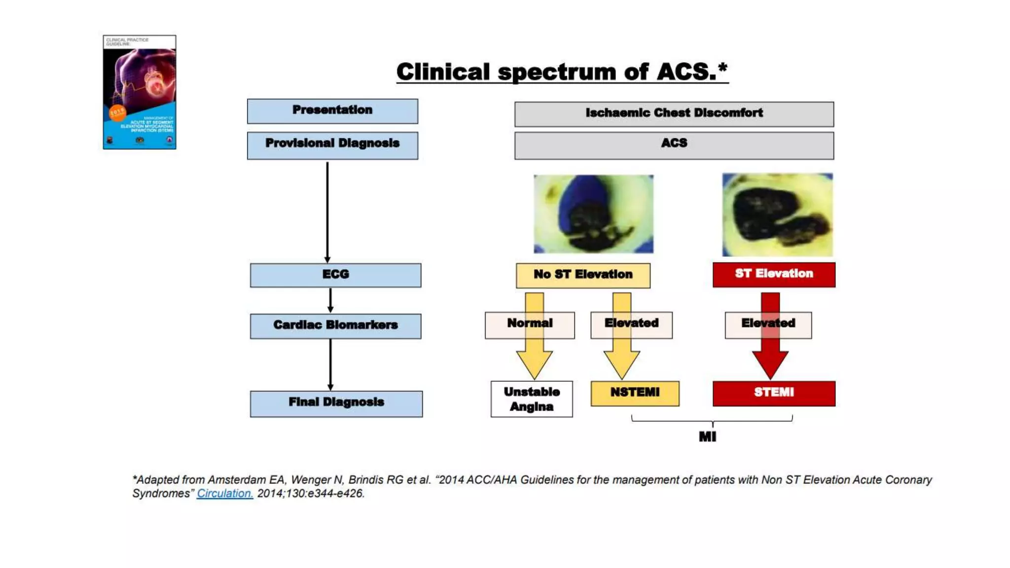 Approach to chest pain | PPTX