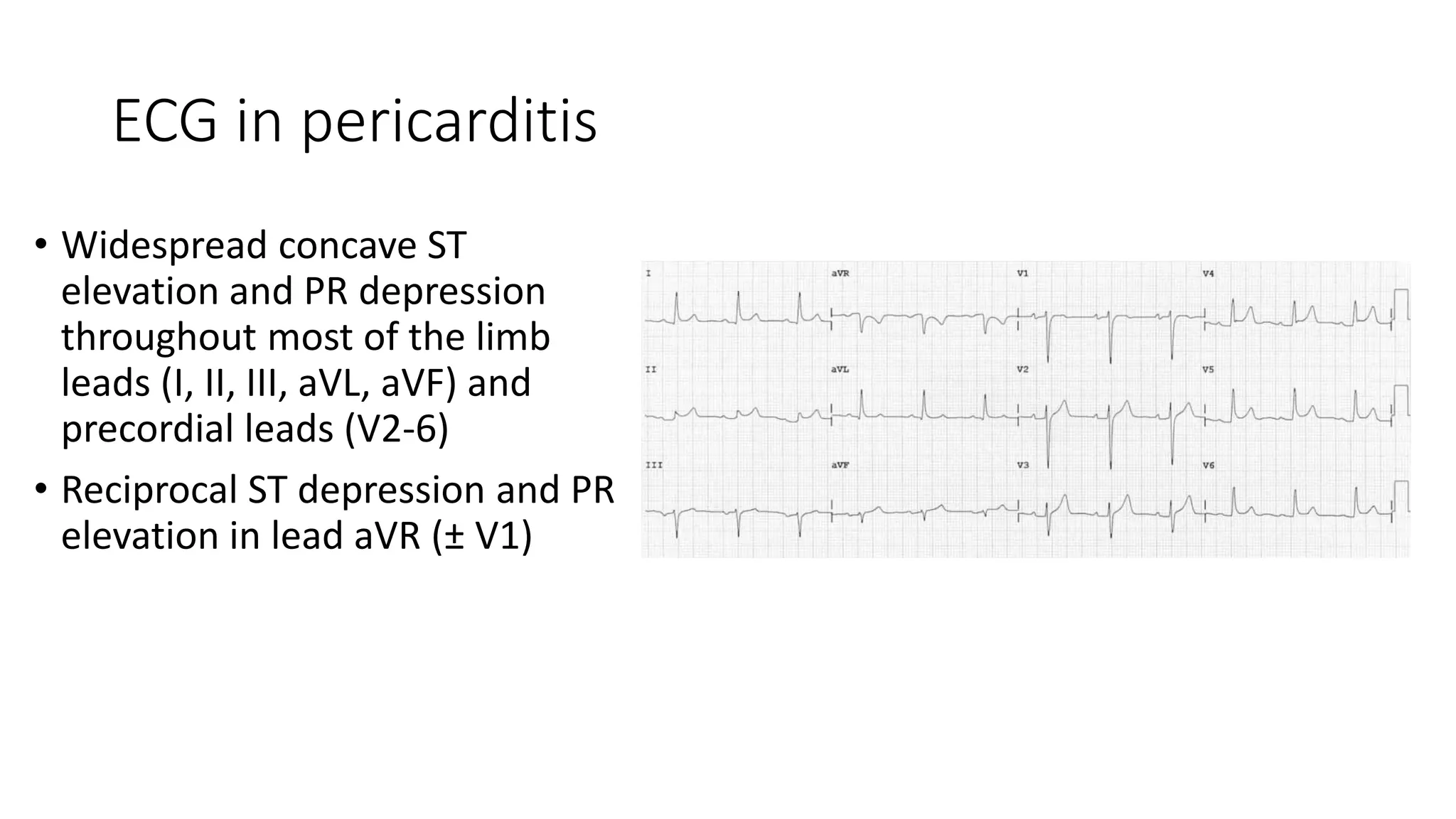 Approach to chest pain | PPTX
