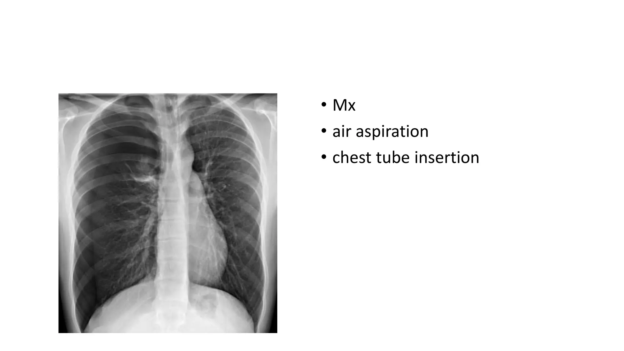Approach to chest pain | PPTX