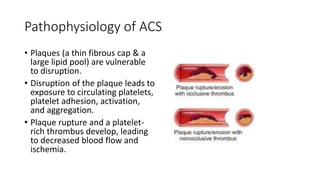 Approach to chest pain | PPTX