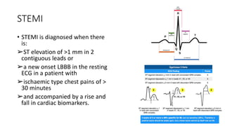 Approach to chest pain | PPTX