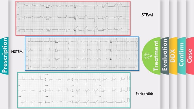 Approach to Chest pain in cardiology .pptx