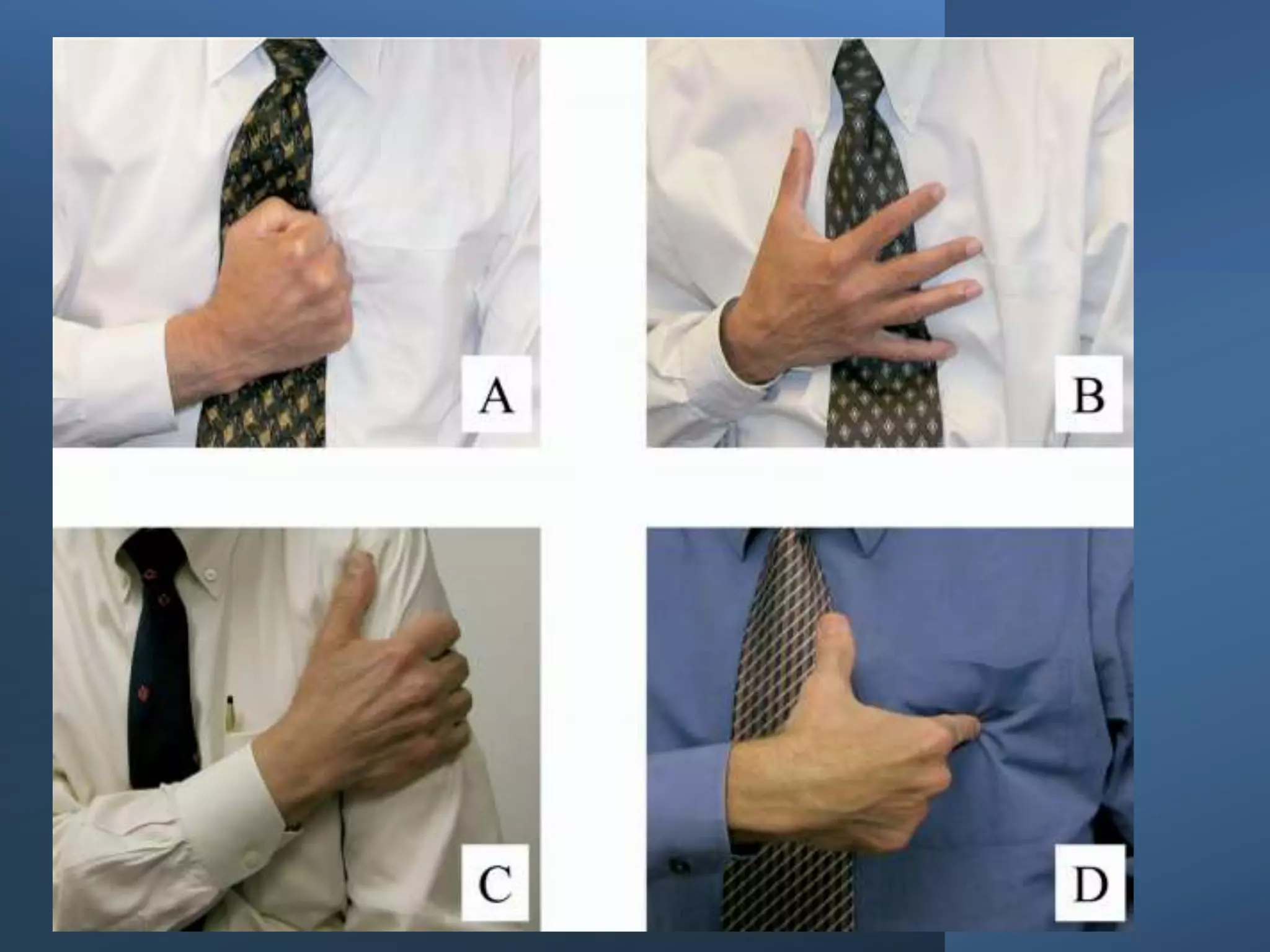 Approach to chest pain, case- based and pericarditis guidelines Ahmed ...