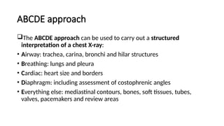 Approach to Chest X-ray interpretation.pptx