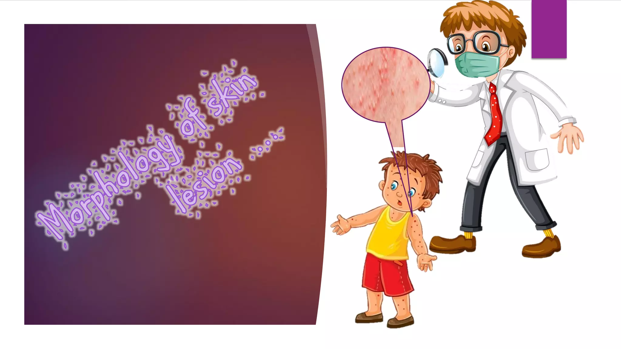 Approach to child – fever with rash | PDF