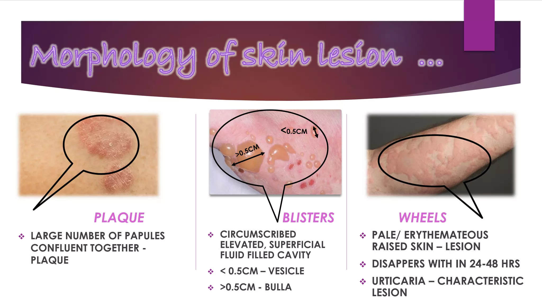 Approach to child – fever with rash | PDF